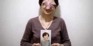 Acharnement thérapeutique / Euthanasie - Encyclopédie médicale